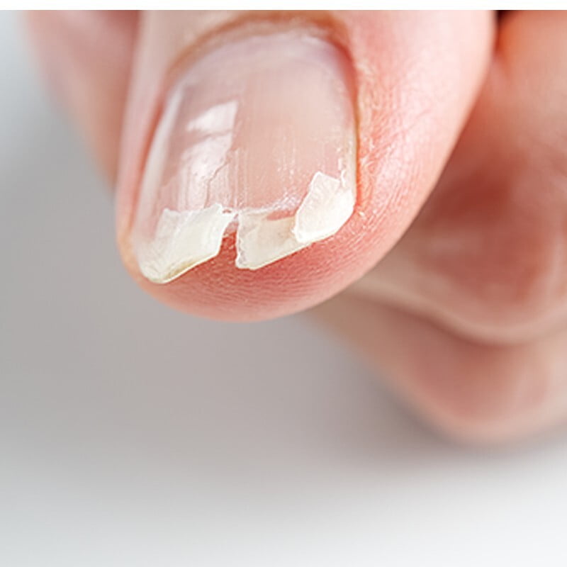 Hair and Nail Disorders